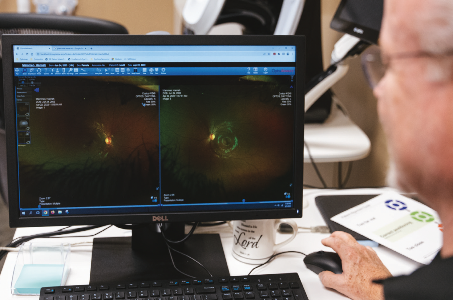 Excellence In Eye Care (Inside Costco) Can Save Your Eyesight Or Even ...